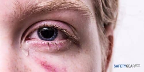 Top 5 Eye Injuries: How to Identify and Prevent Them | Safety Gear Pro